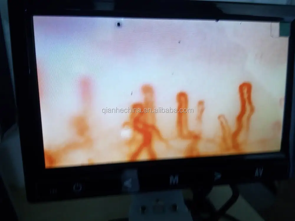 Professional Nailfold Capillary Microcirculation Microscope Test ...