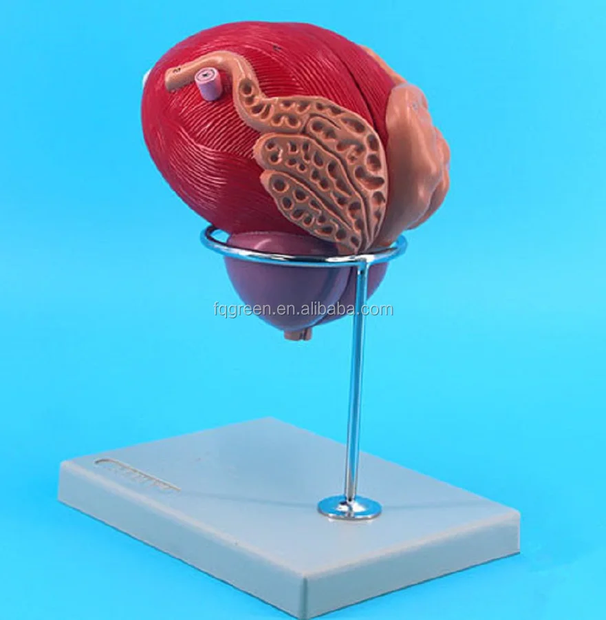 Pathological Model Of Uterus - Buy Human Uterus Pathological Changes ...