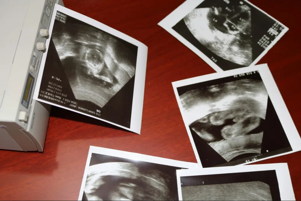 Sony Ultrasound Paper Upp-110s/ultrasound Thermal Paper Roll - Buy Sony ...