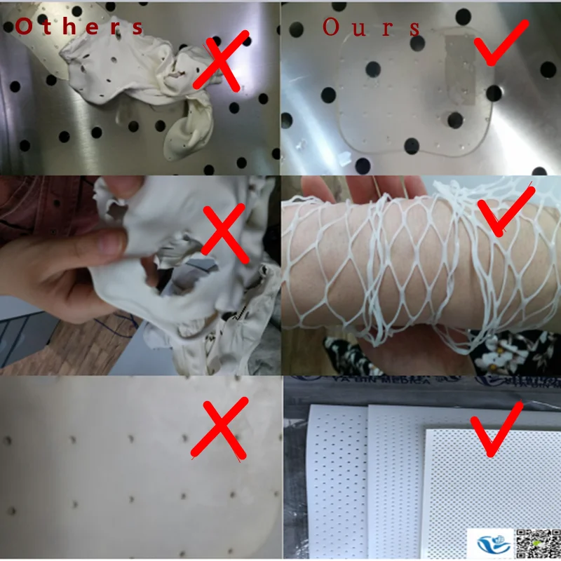 Termoplástico Radioterapia Pelvis Cadera Posicionamiento Y ...