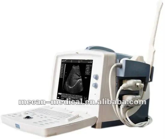 Medical Sonar Portable - Buy Medical Sonar Portable,Portable B ...