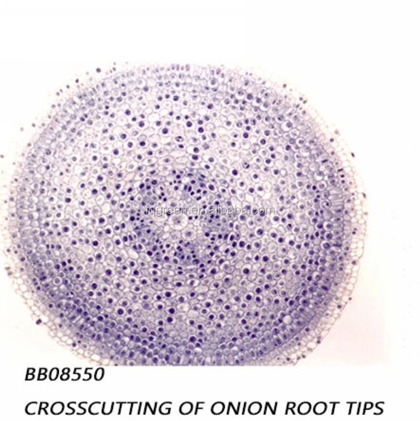 Human Oral Pathology Medical Pathology Prepared Slides - Buy Tooth ...