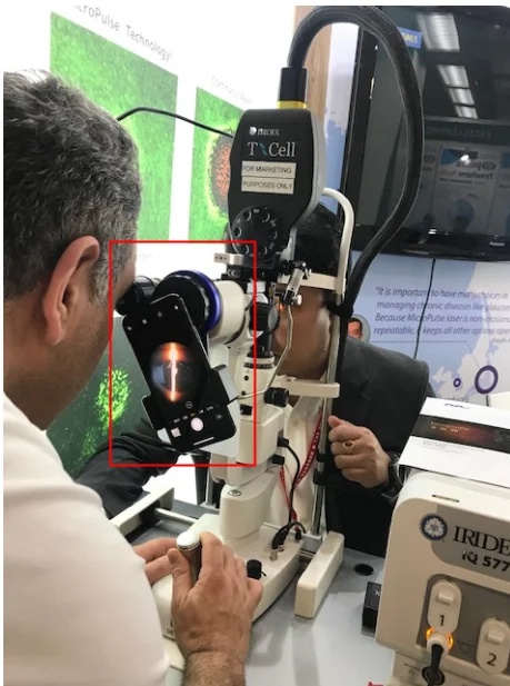 Universal Smartphone Photo Adapter For Slit Lamp - Buy Mobile Phone ...