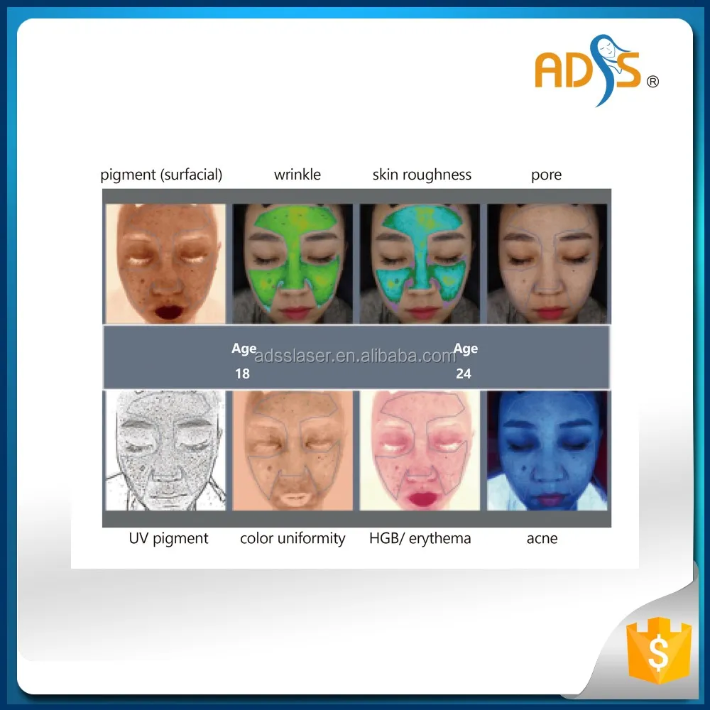18 Million Pixel Facial Skin Analyzer Machine For Skin Testing/digital ...