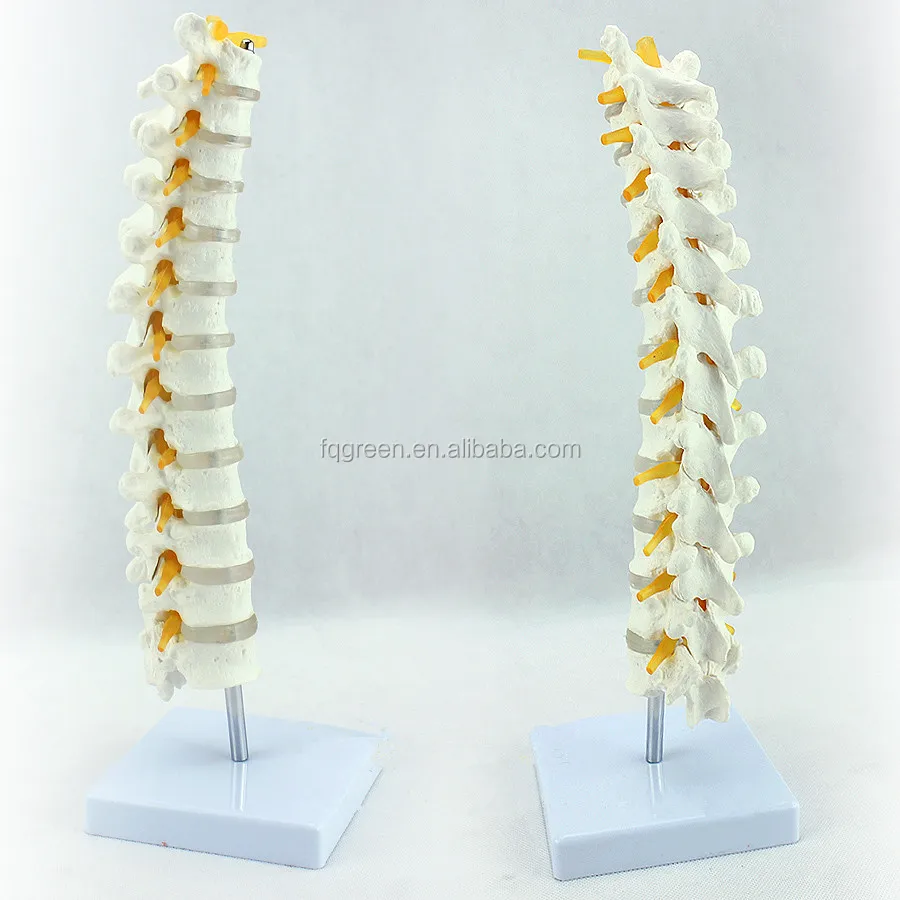 Lumbar Vertebrae Sacum With Nerves Model - Buy Lumbar Vertebra/ Nervi ...