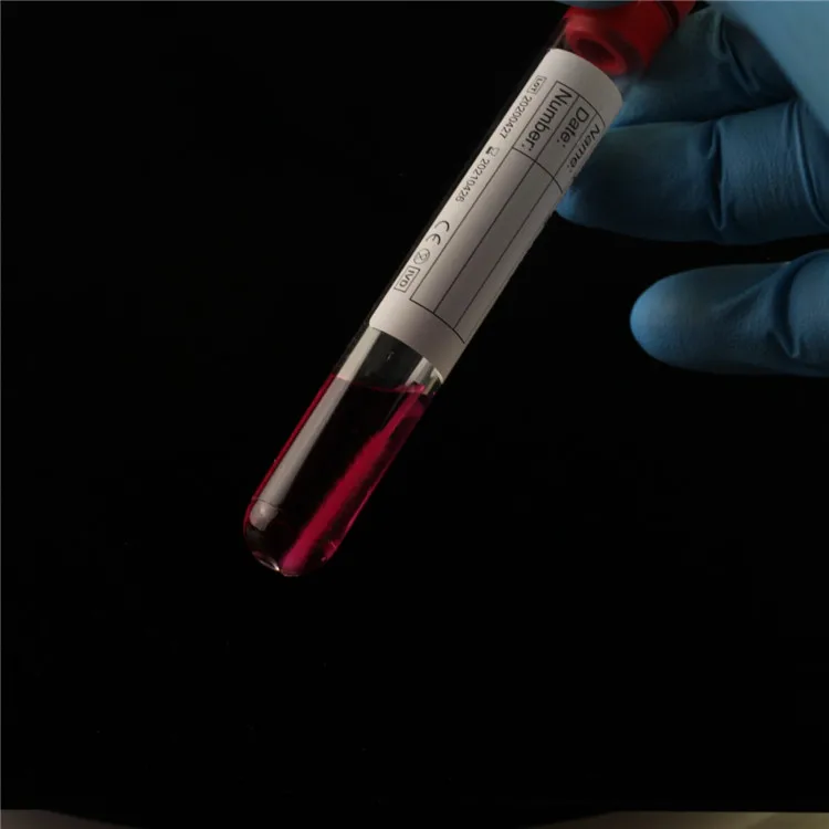 Universal Viral Transport Collection Kit Lab Tube Vtm With Nasal Swab ...