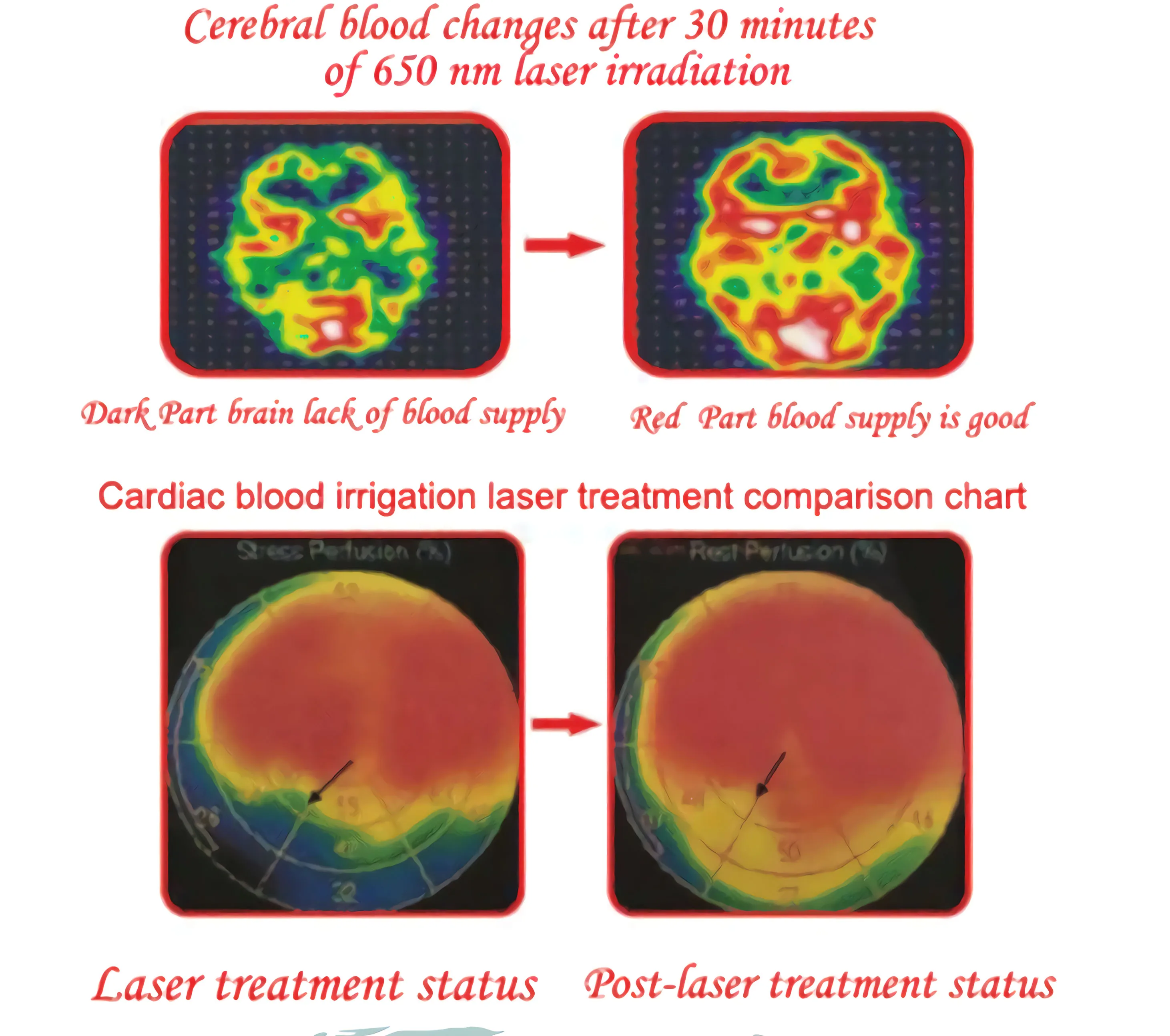 Rhinitis Treatment Instrument Allergic Rhinitis Artifact Sinusitis ...