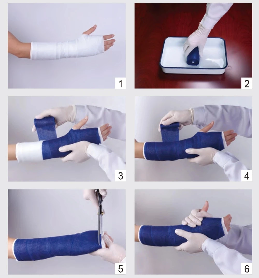 Medical Orthopedic Casting Tape Packaging Pouch Surgical Synthetic ...