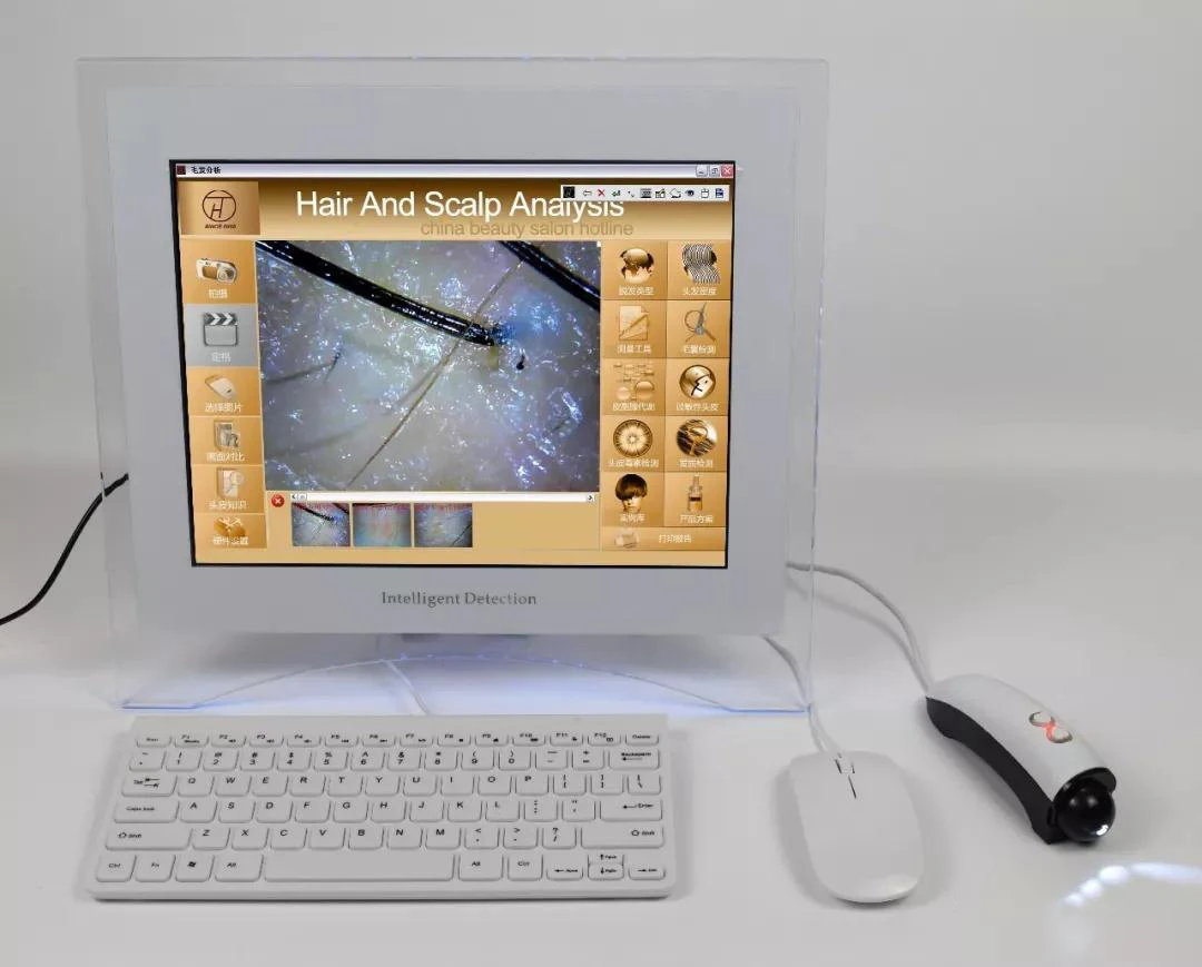 Portable Hair And Scalp Analyzer / Hair Skin Analysis Device - Buy Hair ...