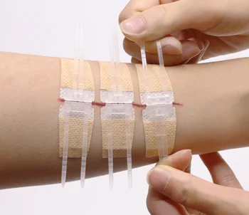 Zipstitch Zip Stitch First Aid Emergency Kit Wound Closure Device No ...