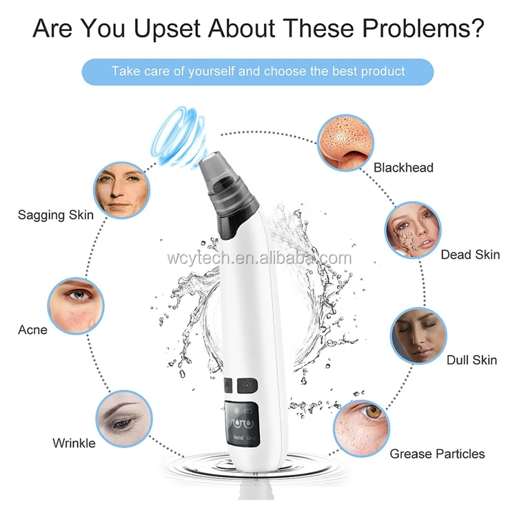 Hot Electric Pimple Removal Suction Extractor Tool Kit