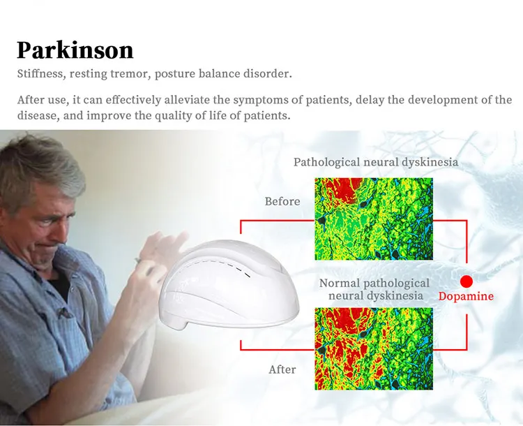 Near Infrared 810nm Brain Stimulation Healing Photobiomodulation Helmet ...