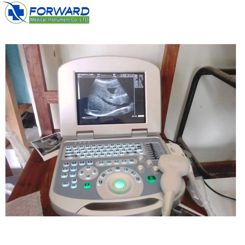 Medical Echography Portable Ultrasound Machine 3d 4d - Buy Portable ...