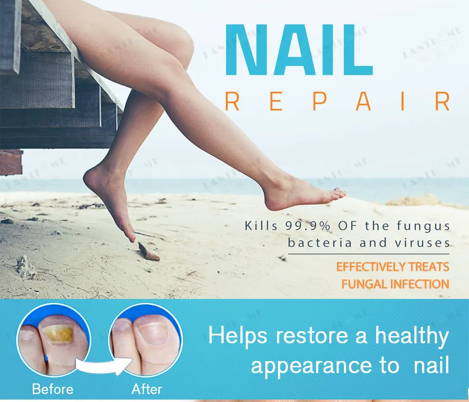 Lanthome Herbal Nail Repair Pen Anti Fungal Nail Nourishing Renew Nail ...