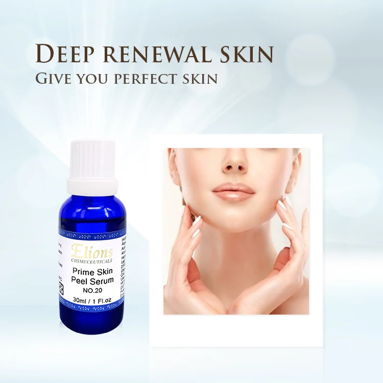 Private Label Acne Scar Serum 20% Peel Remove Blemish Chemical Skin ...