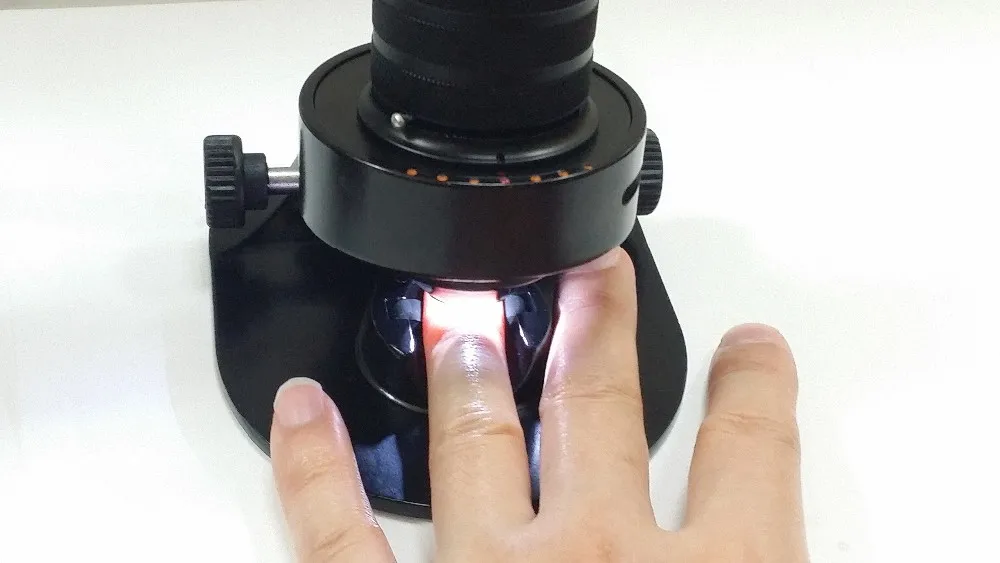 Dmx980-1 Biological Microcirculation Microscope,Nail Fold Capillary ...