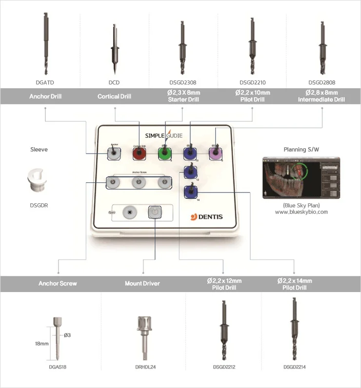 [dentis Implant Dental Guide System] Simple Guide - Buy Dental Guide System,Dental Guide,Digital ...