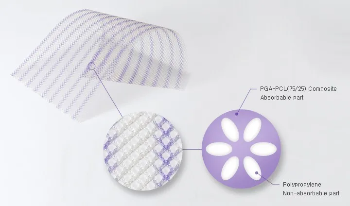 Duzey Surgical Partially Absorbable Composite Mesh Pga/pcl-polyproylene ...