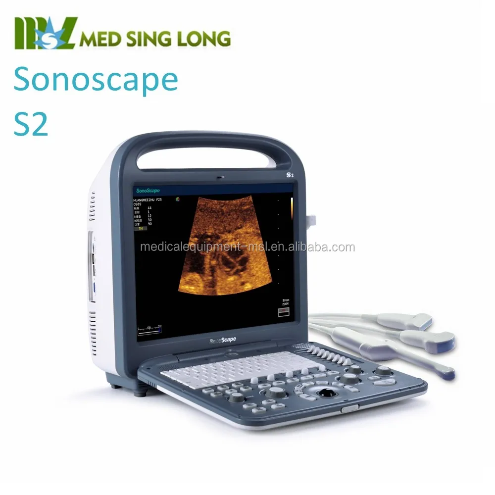Ce Iso Fda Sonoscape S2 Portable Ultrasound Scanner Msk Pregnancy Test ...