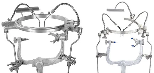 Leyla Retractor System / Neurosurgery Brain Retractor System - Buy ...